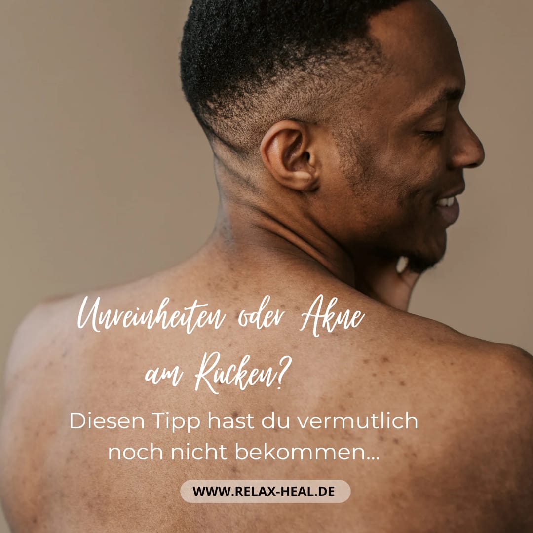 Unreinheiten, Pickel oder Akne am Rücken? Diesen Tipp hast Du ...